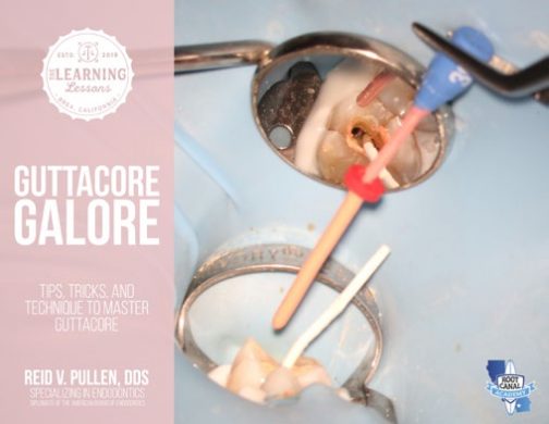 Guttacore Galore - Root Canal Academy