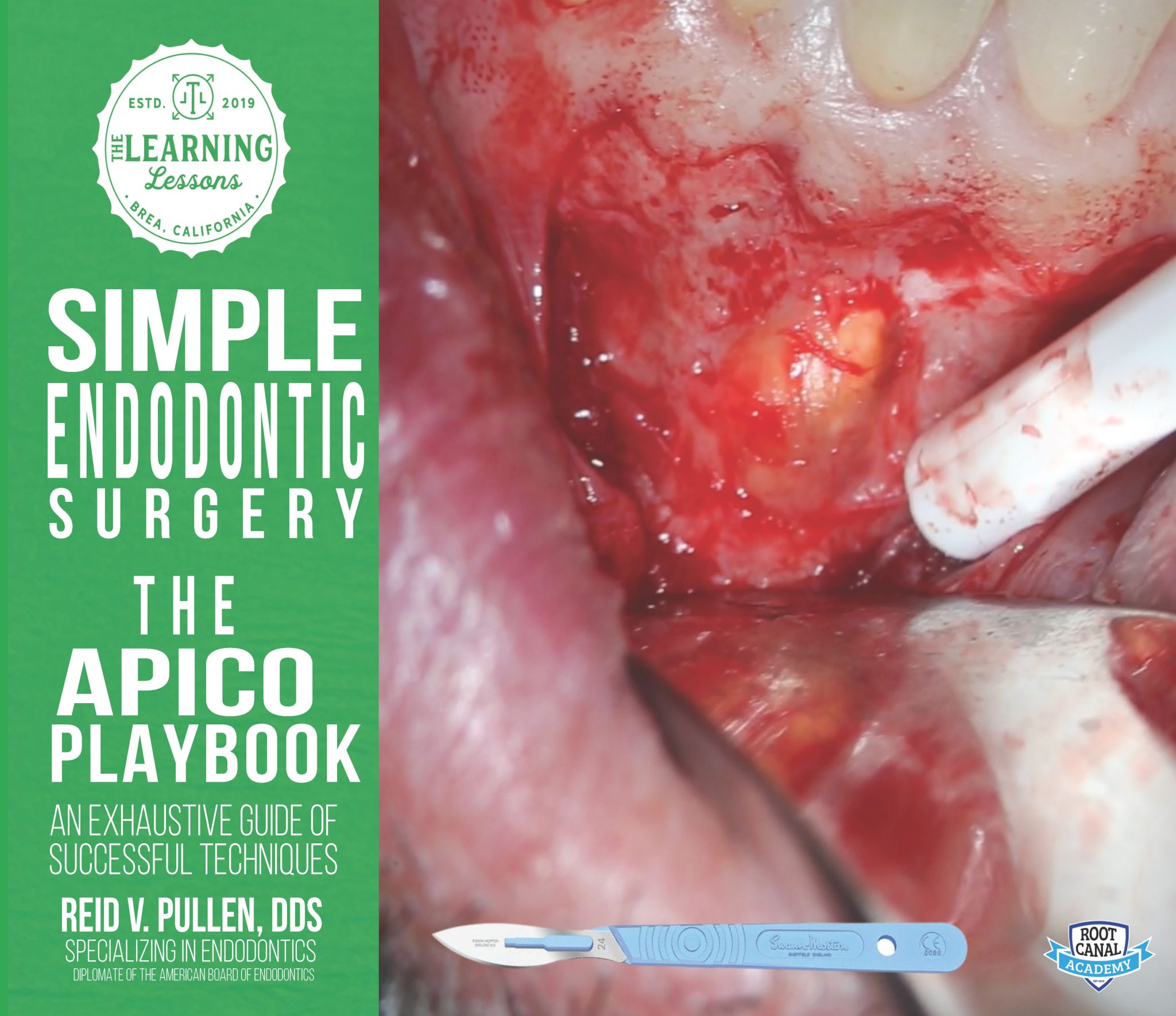 Simple Endodontic Surgery: The Apico Playbook - Root Canal Academy